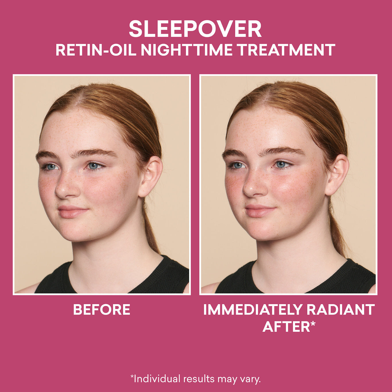 Sleepover Retin-Oil Nighttime Treatment|30 ml / 1 fl oz